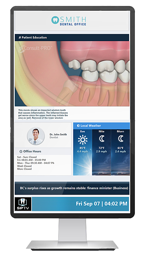 Consult-PRO Smile-PRO TV